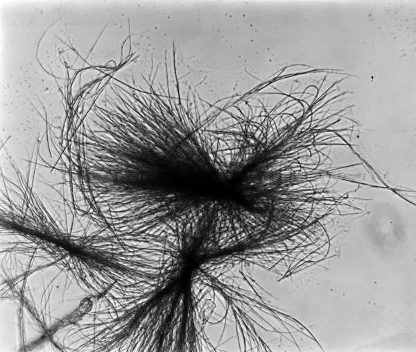 Photograph of porphyrin crystals through a microscope‘, Anonymous ...