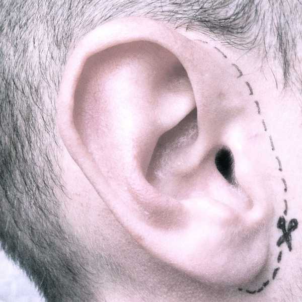 Detachable Ears | Tate Britain